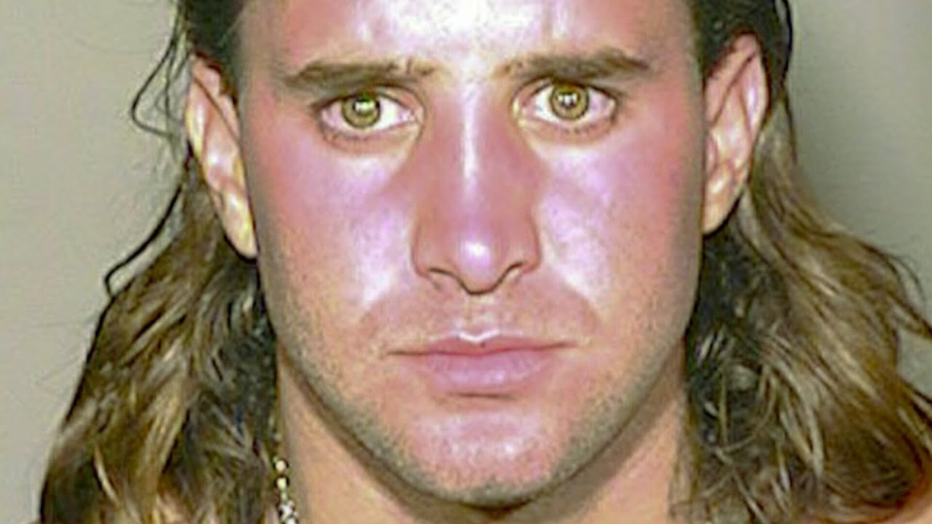 Rock stars who partied too hard