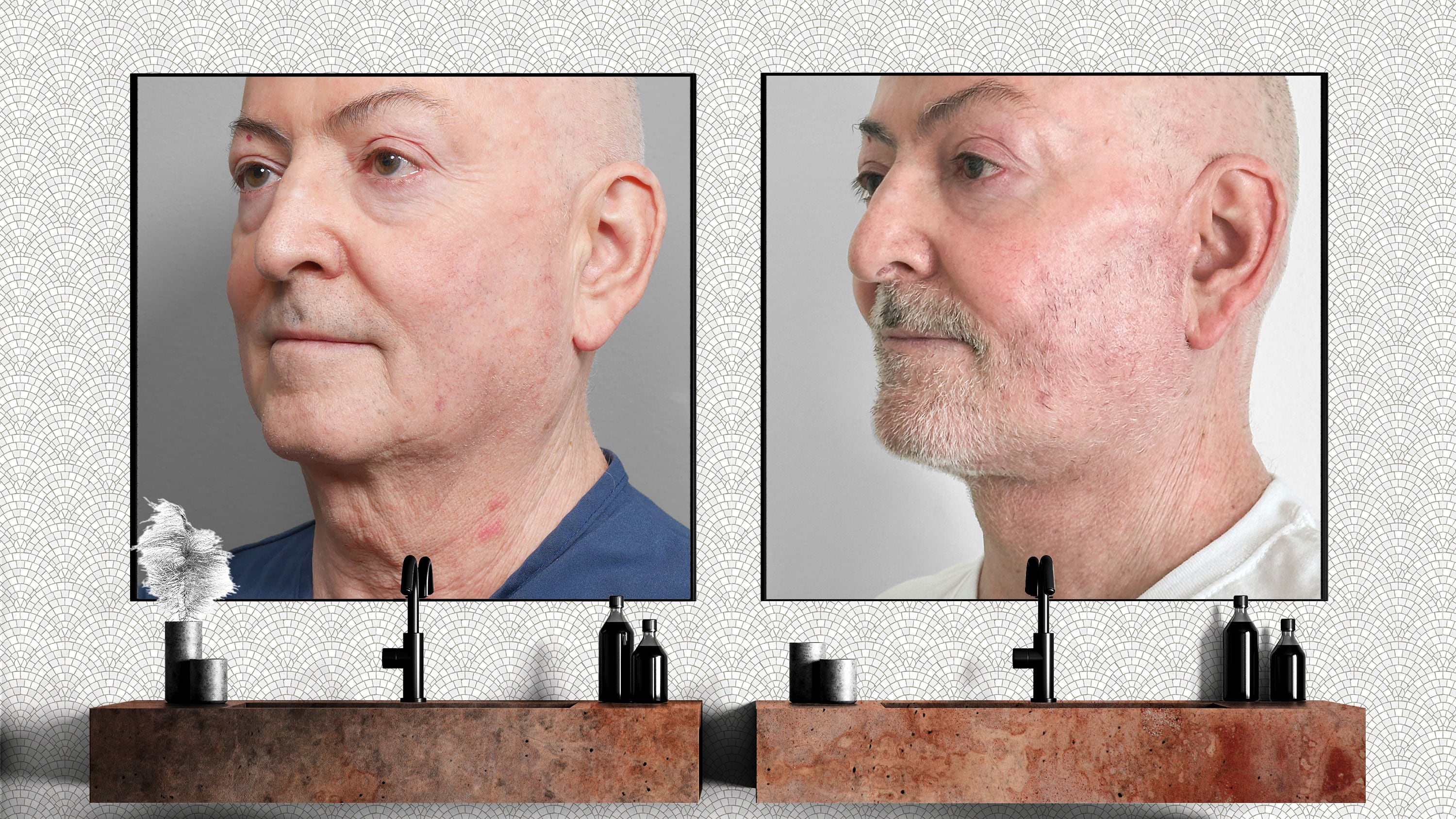 This man’s drastic $75K jawline transformation is, well, jaw-dropping