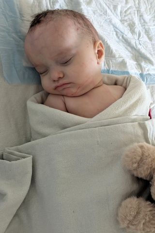 Mom notices baby's 'odd-shaped head' after traumatic birth. Weeks later ...