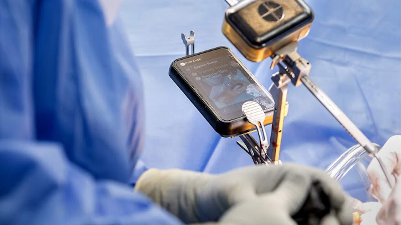 New handheld device brings precision hip replacements to Charleston