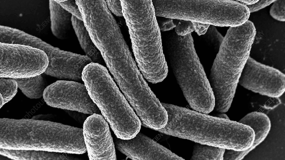 Health department investigates E coli outbreak linked to Japanese ...