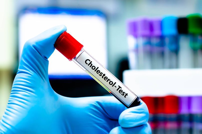 NHS warns women taking atorvastatin to speak to GP at key life stage ...