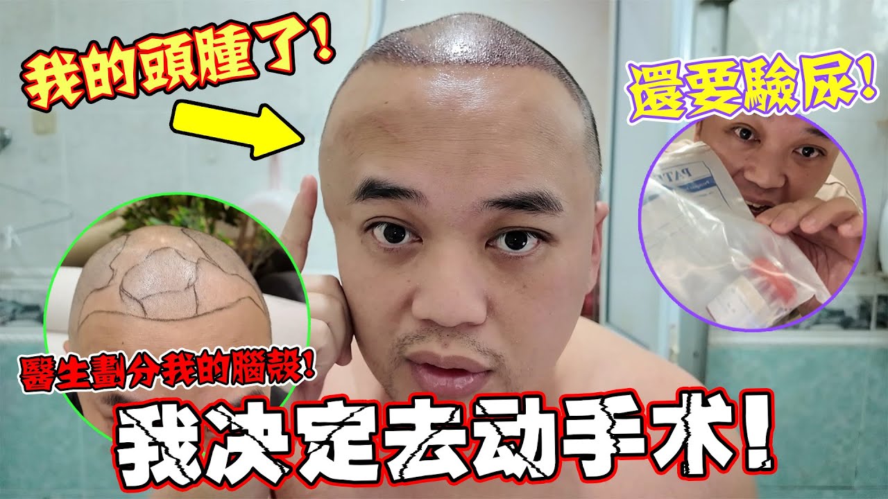 I've decided to have hair transplant surgery, and you can experience ...