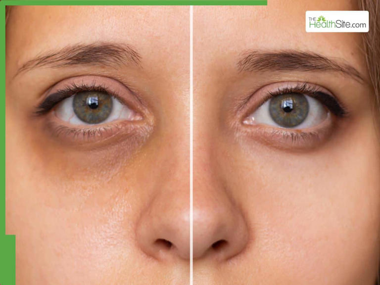 Natural benefits of applying ghee under the eyes: How this remedy works