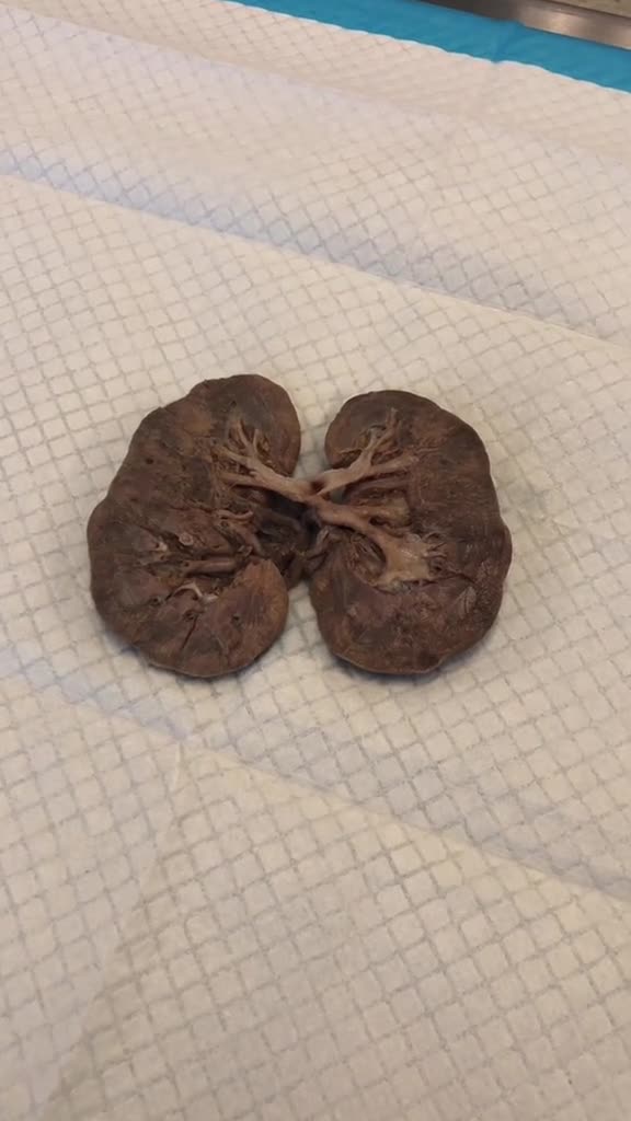 Can you guess these real human organs? Test your anatomy skills!