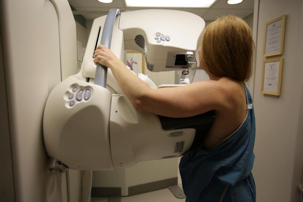 Manitoba lowering breast cancer screening age to 45