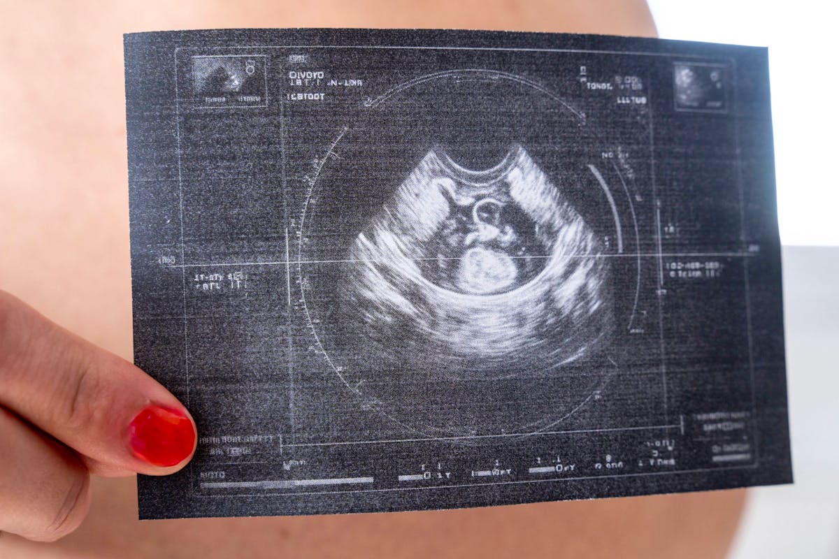 Frauen werden schwanger – trotz intaktem Jungfernhäutchen