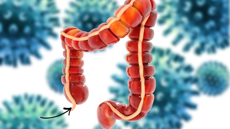 Did you know the role appendix plays in your body? It is more important ...