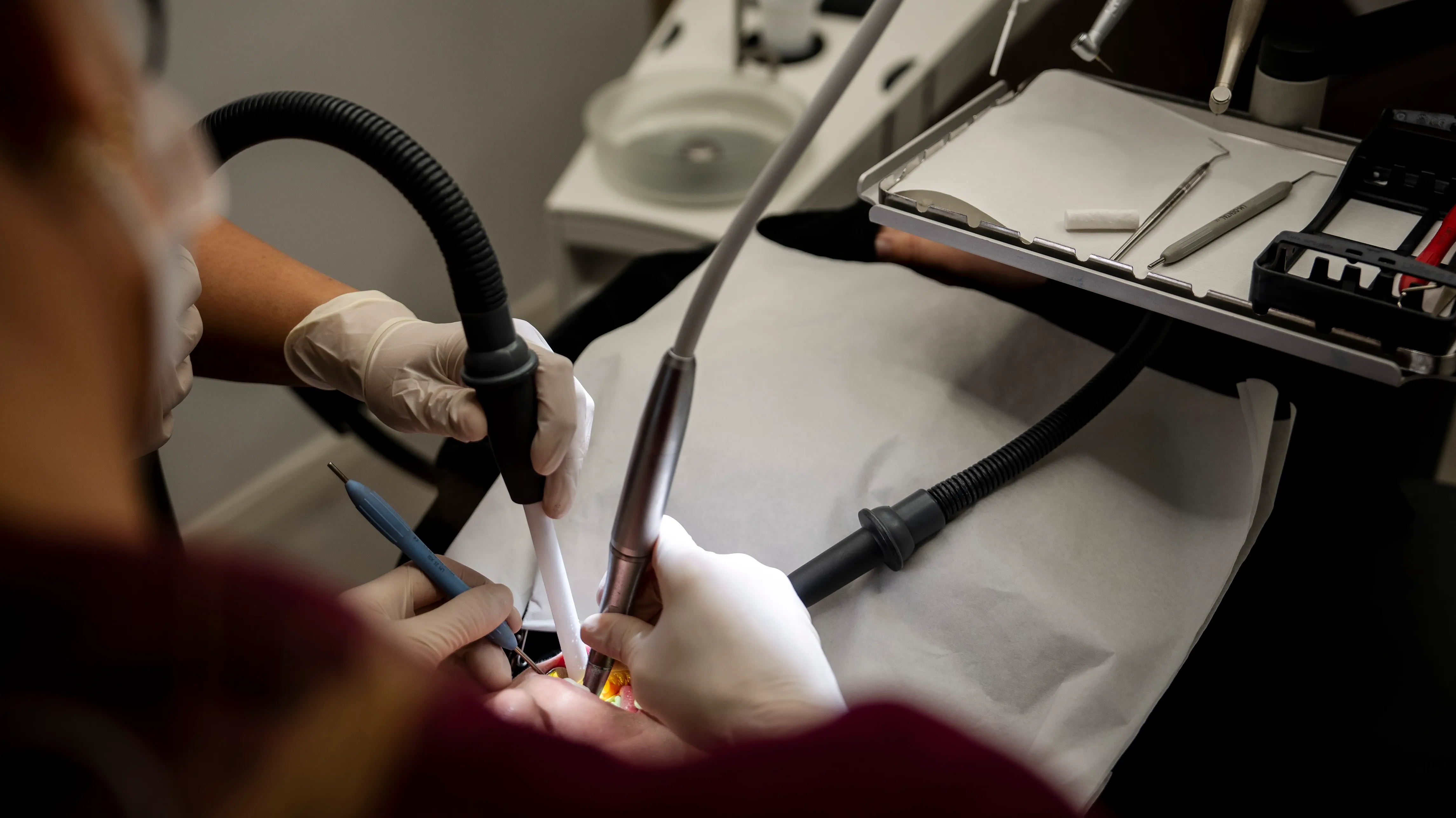 Årets travleste dage: Tandlægekæde hæver akutberedskabet