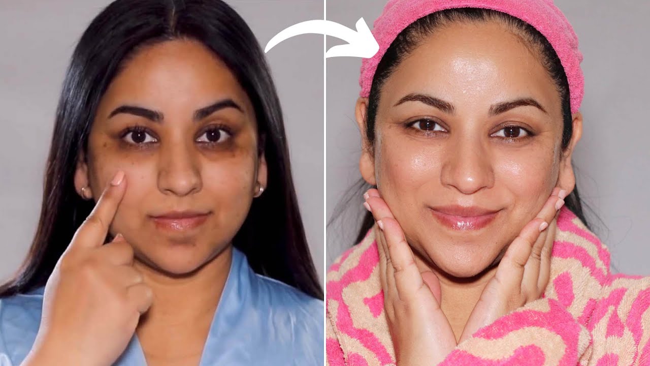 How I faded hyperpigmentation with one routine change