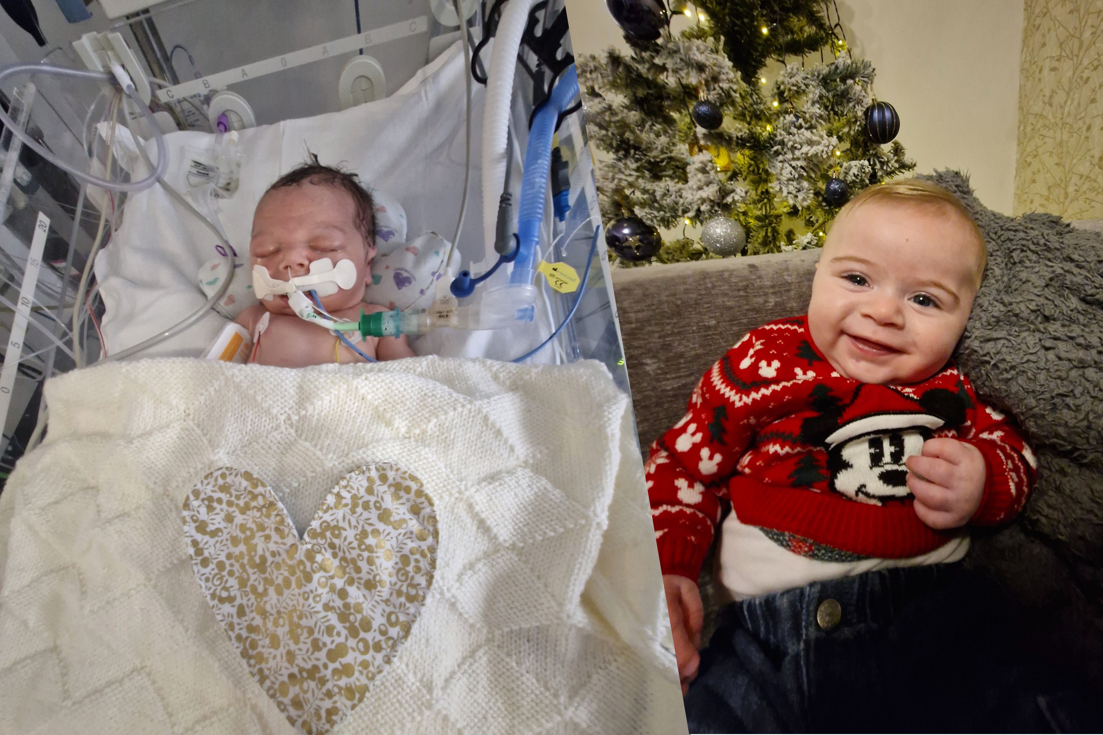 Open heart surgery saves one-week-old Sheffield baby's life - and now ...