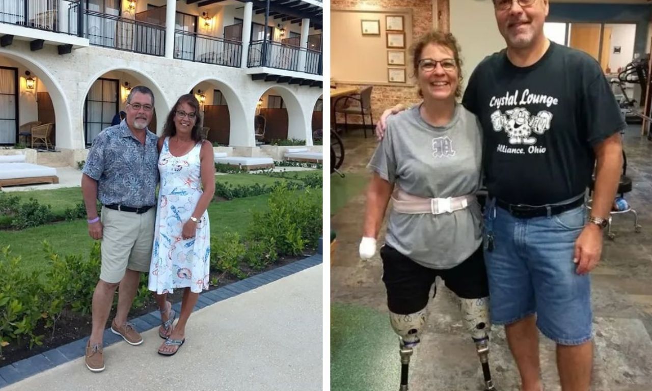 Mujer pierde brazos y piernas tras infección causada por su perro: “Fue ...