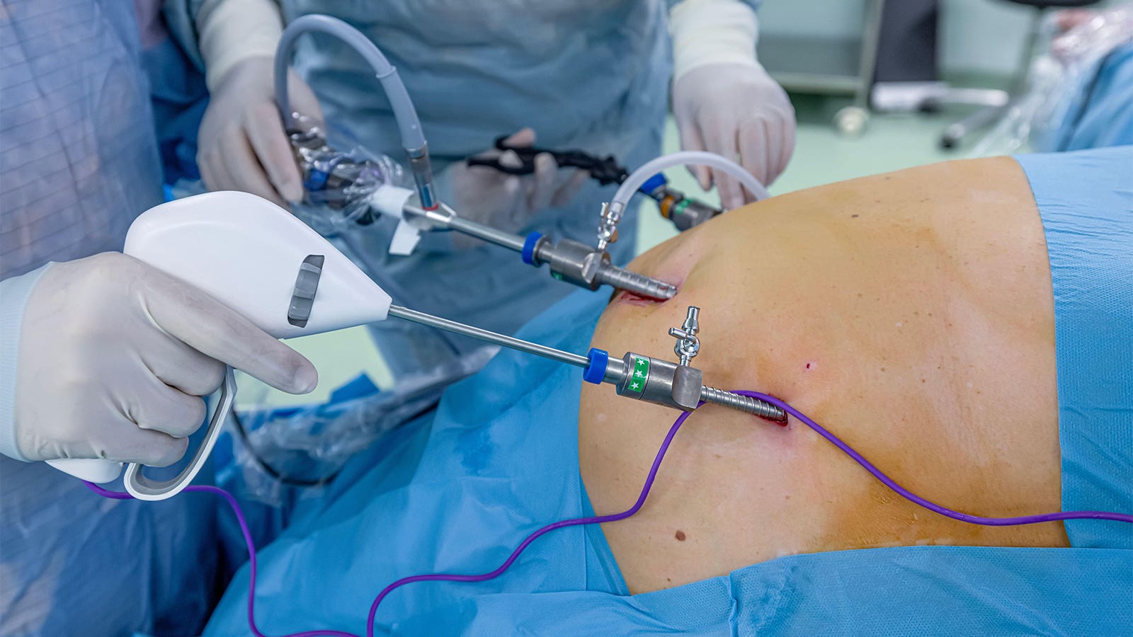 Incretin therapies after bariatric surgery linked to lower risk of ...