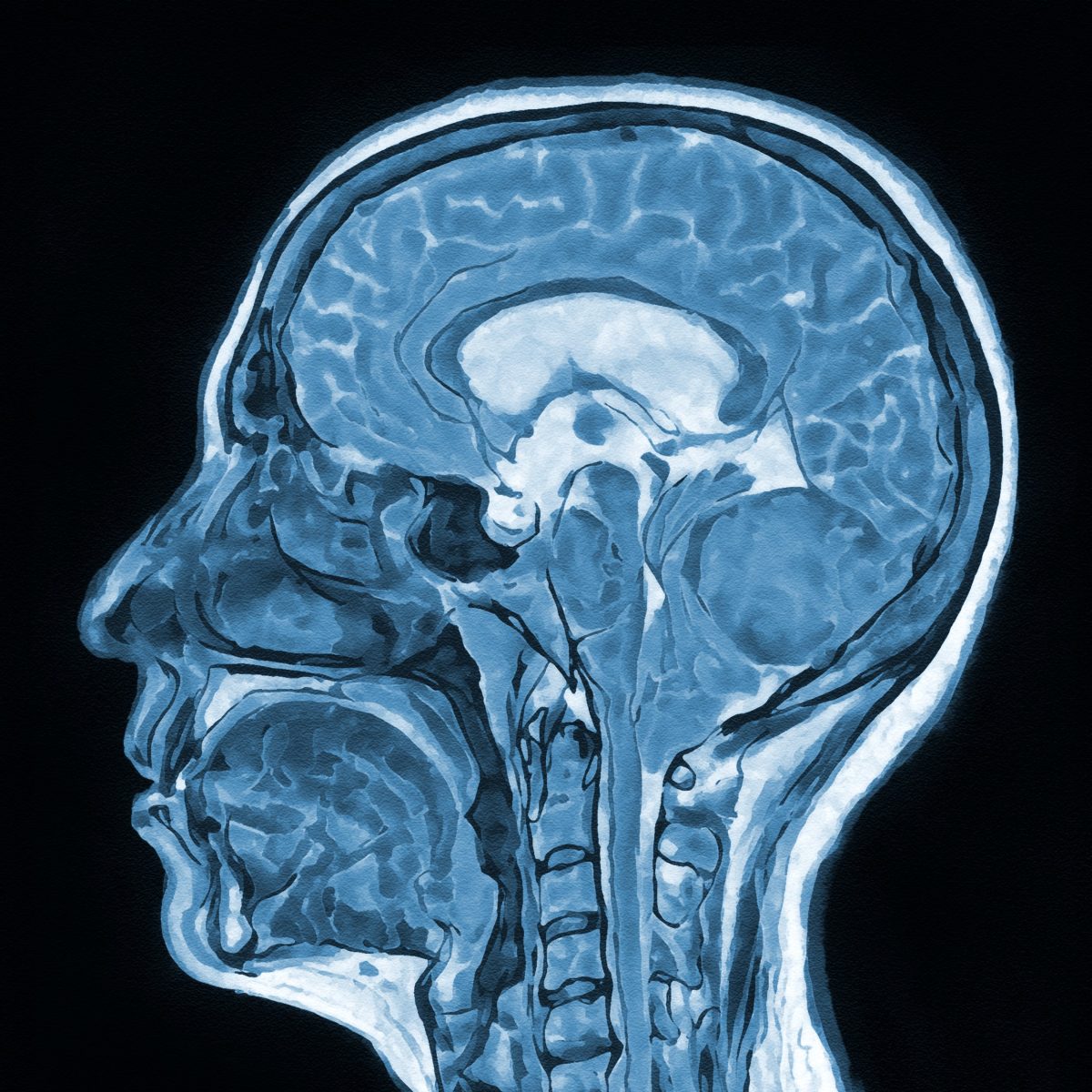 Depression, anxiety and PTSD have same genetic roots – what it means ...