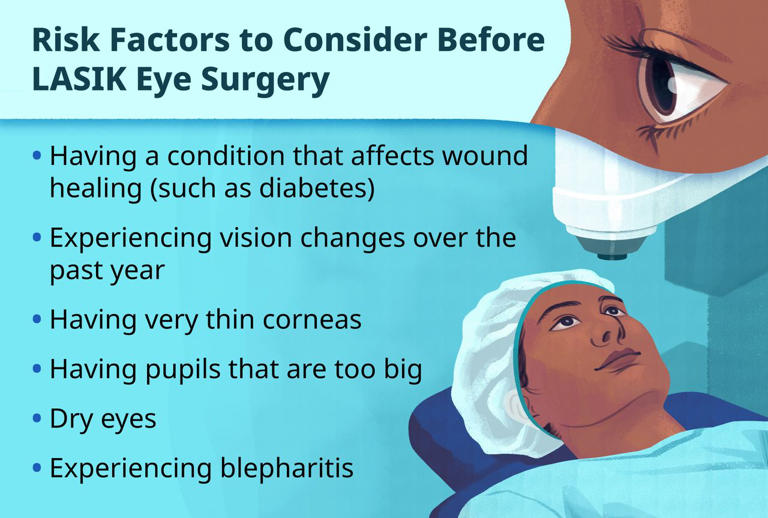 LASIK eye surgery: Factors to consider