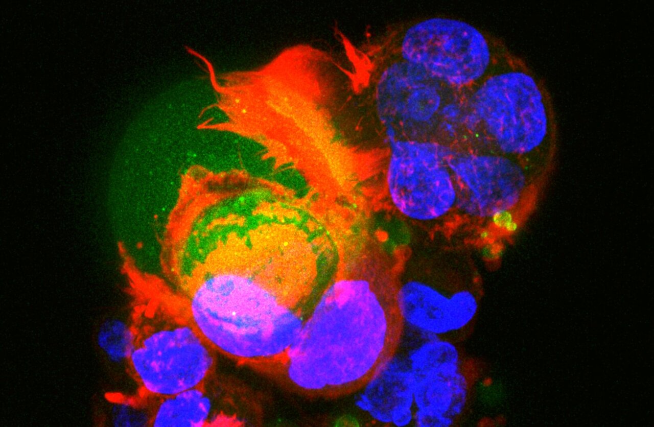 Mini-tumors combine synthetic and real cells to simulate immune responses
