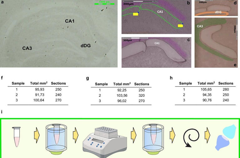 How hippocampal synapses adjust their proteins to specialize their function
