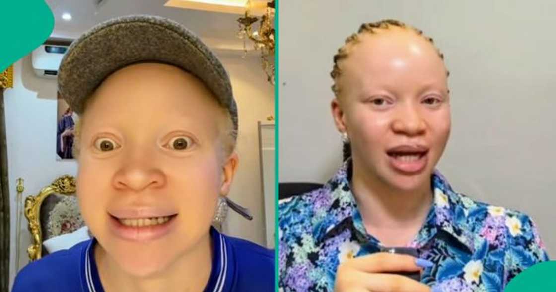 Albino lady shares her personal experience with eyesight, says she can ...