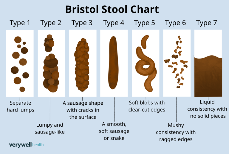 Are narrow stools a health warning?