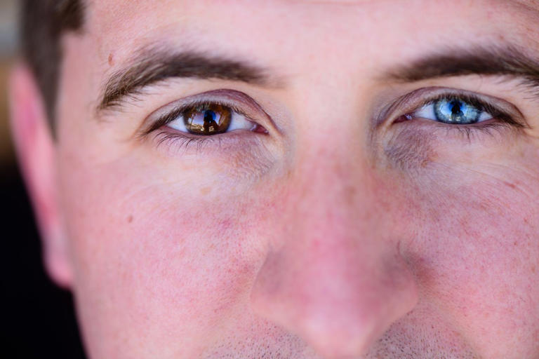 Discover the rarest eye colors in the US