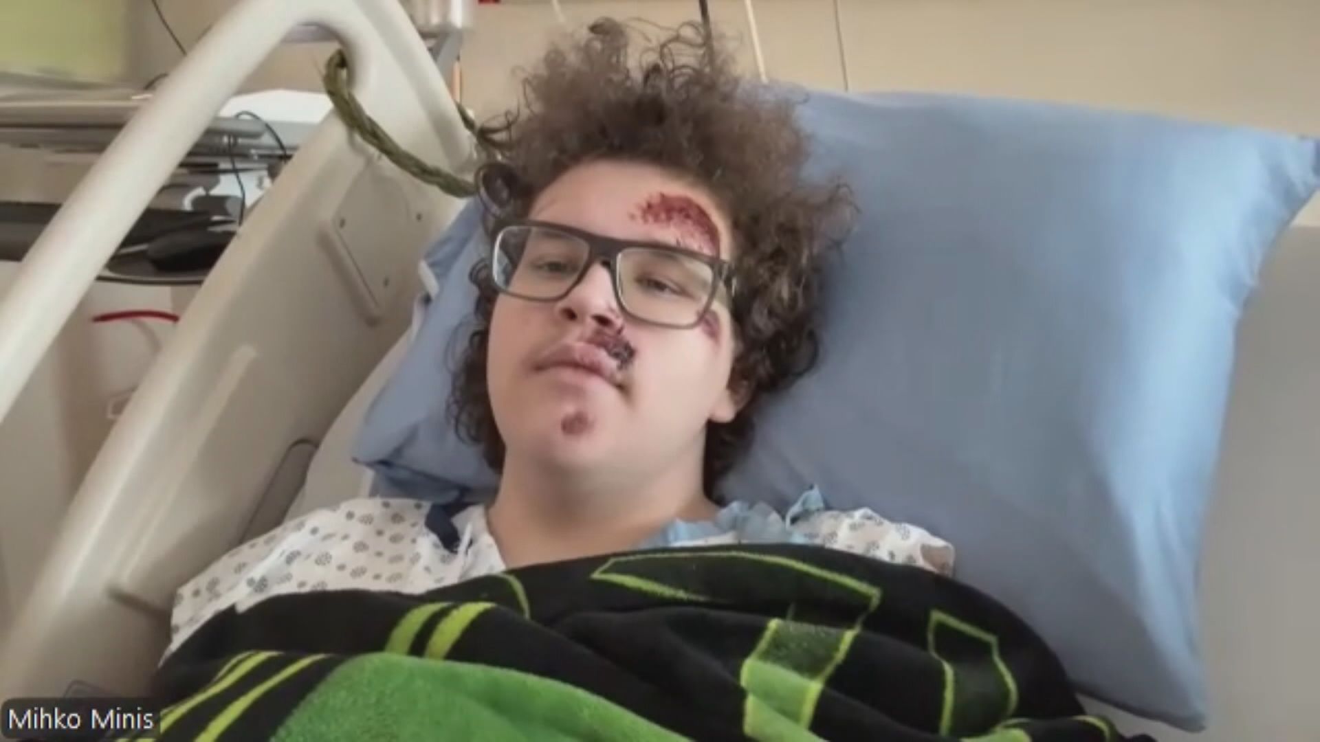 Calgary teen hit by pickup truck faces long road to recovery