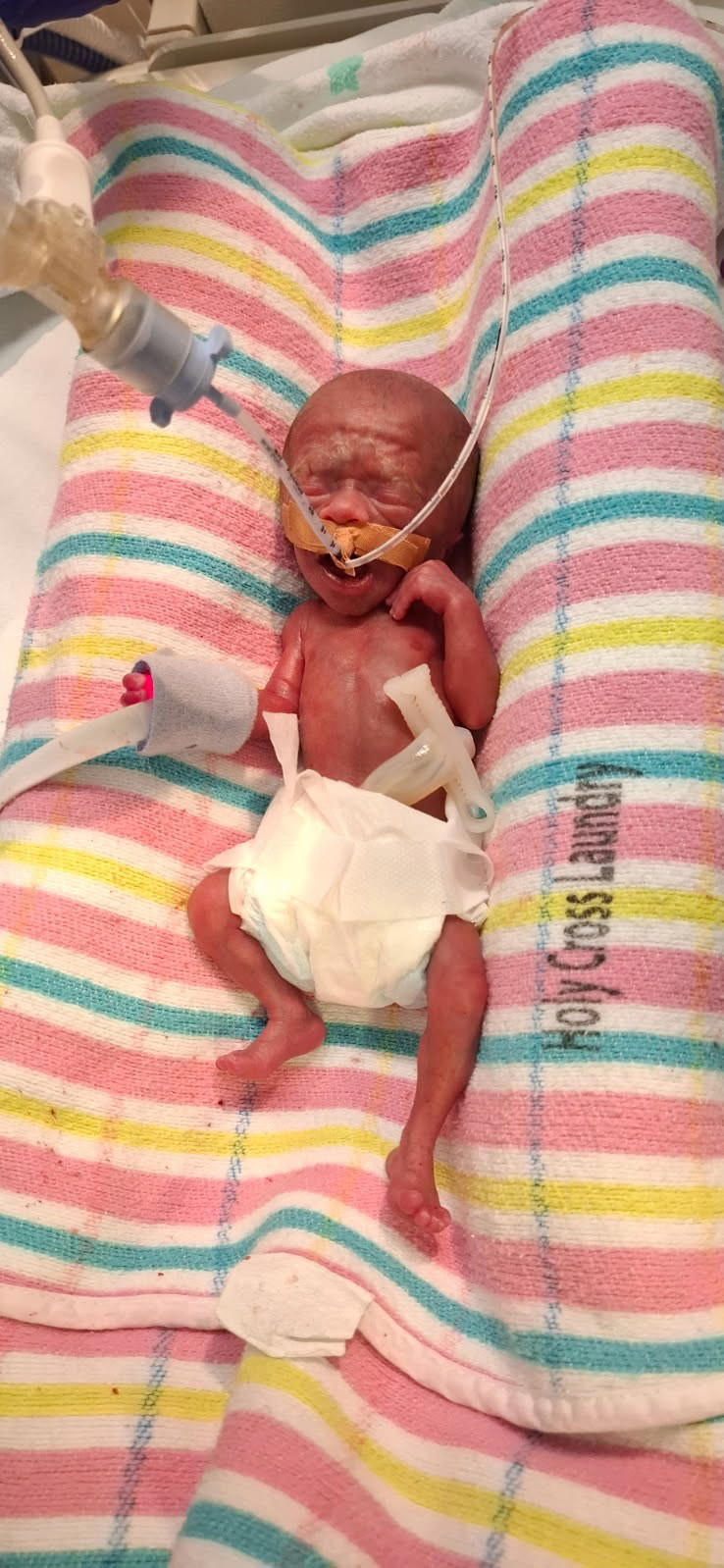 Tiny newborn Charlie breaks record as Queensland's smallest baby