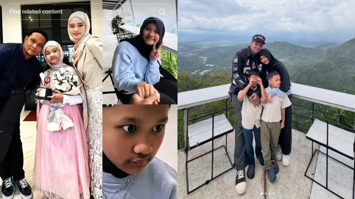 Virgoun ubah penampilan Strala jadi lebih cantik, Putri Inara Rusli hilangkan tanda lahir di wajah