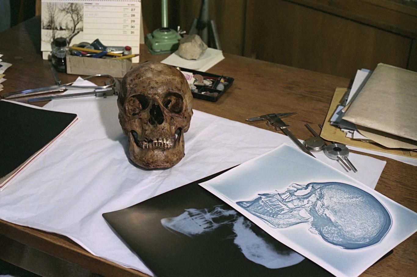 Karel IV. na pokraji smrti: rozdrcená čelist, zlomený krk a středověký ...