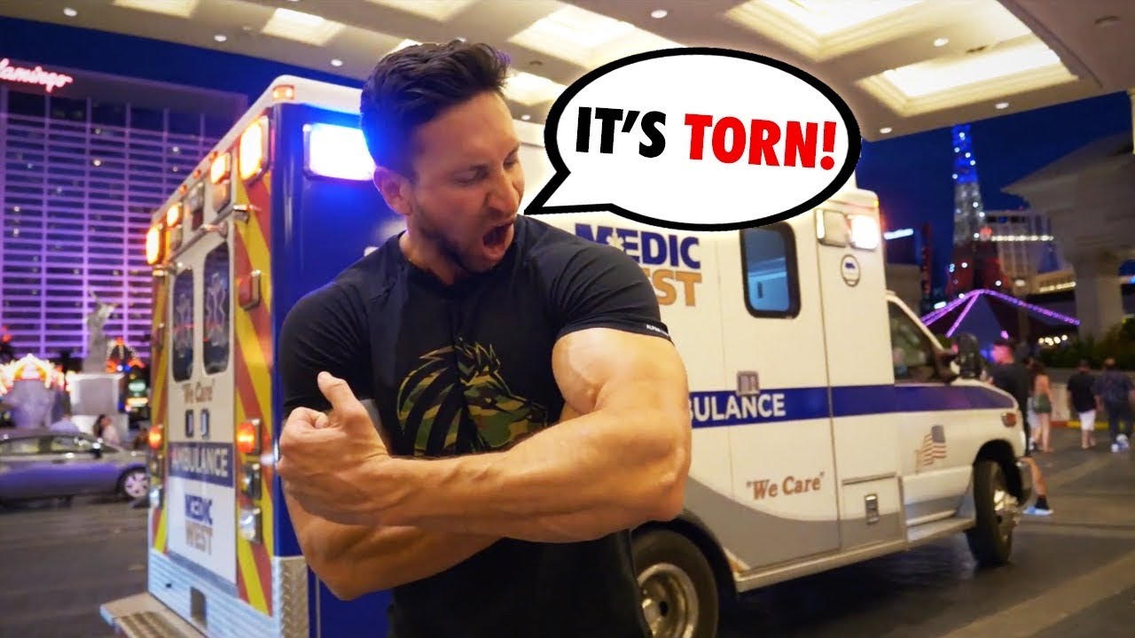 I tore my bicep training arms every day