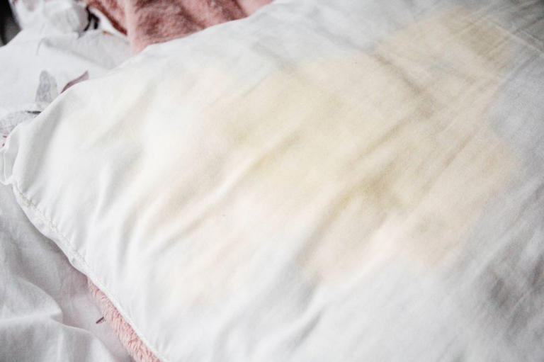Get rid of yellow pillow stains with 1 natural item mixed with water ...