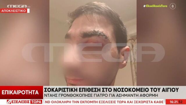 Σοκ στο Αίγιο: Ασθενής νοσοκομείου χτυπούσε ασταμάτητα γιατρό - Τι ...