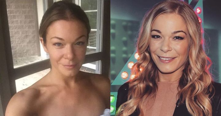Stars unfiltered: Celebs without makeup