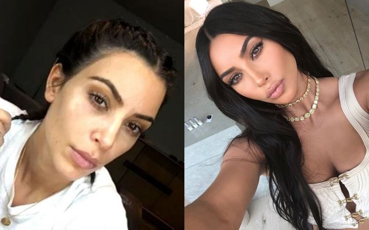 Stars unfiltered: Celebs without makeup