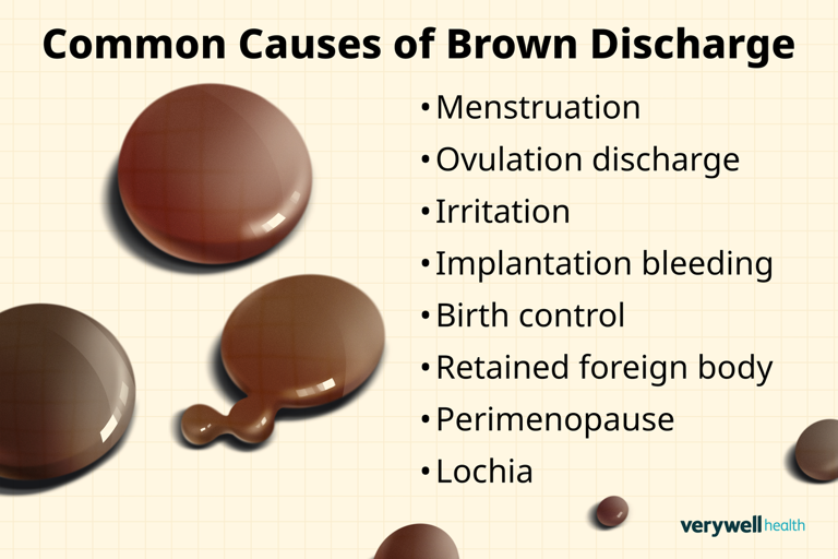 Brown discharge and its causes