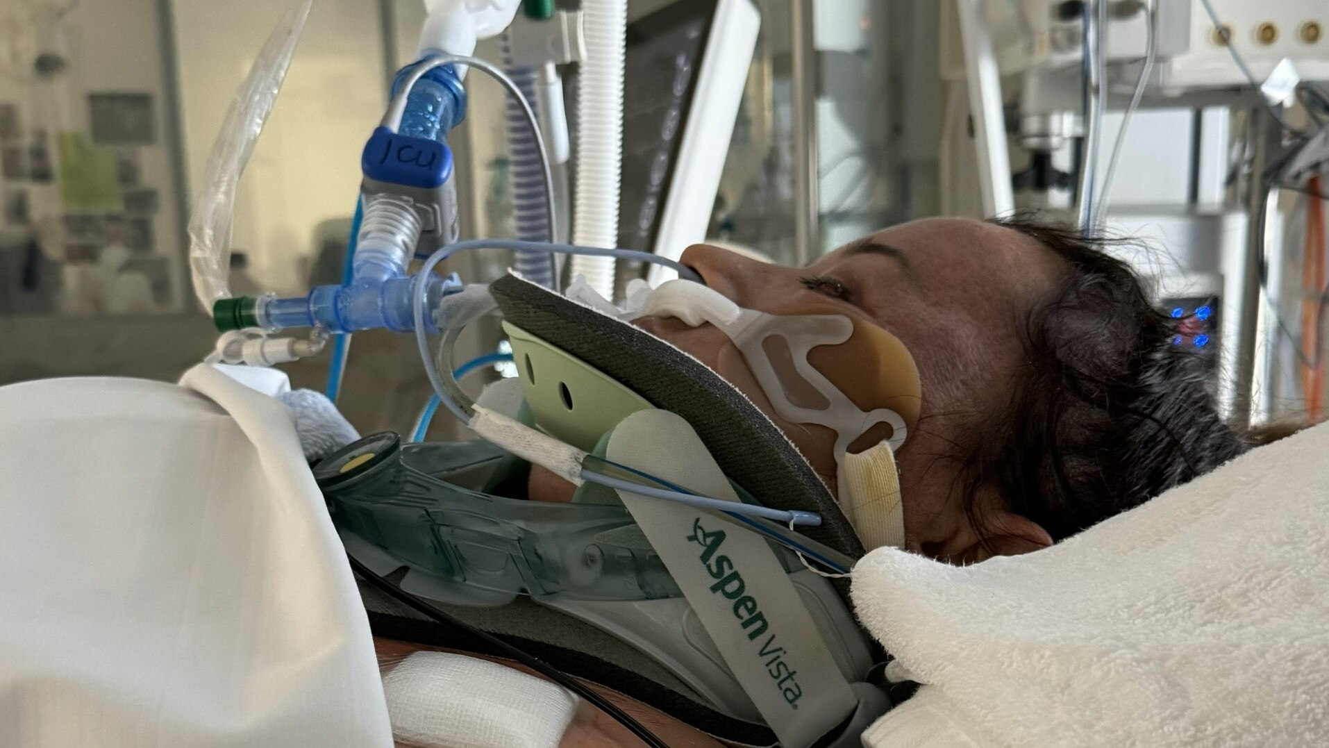 After being run over by a car while sunbaking, Sam reunites with ...