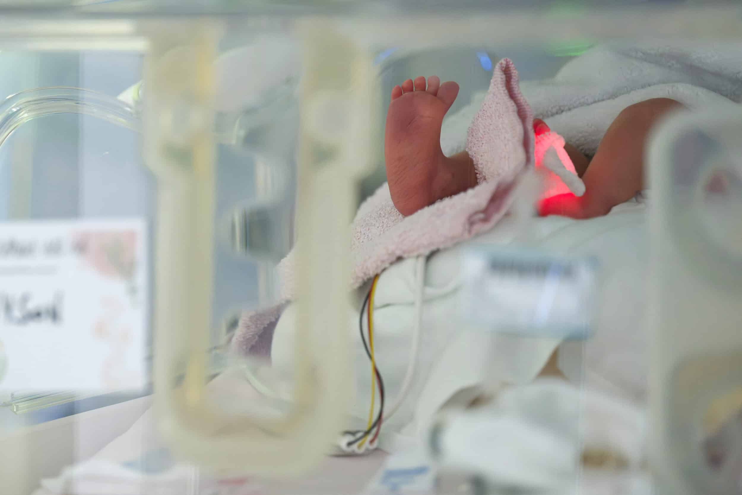 A rare abdominal pregnancy shocked doctors and the baby who survived is ...