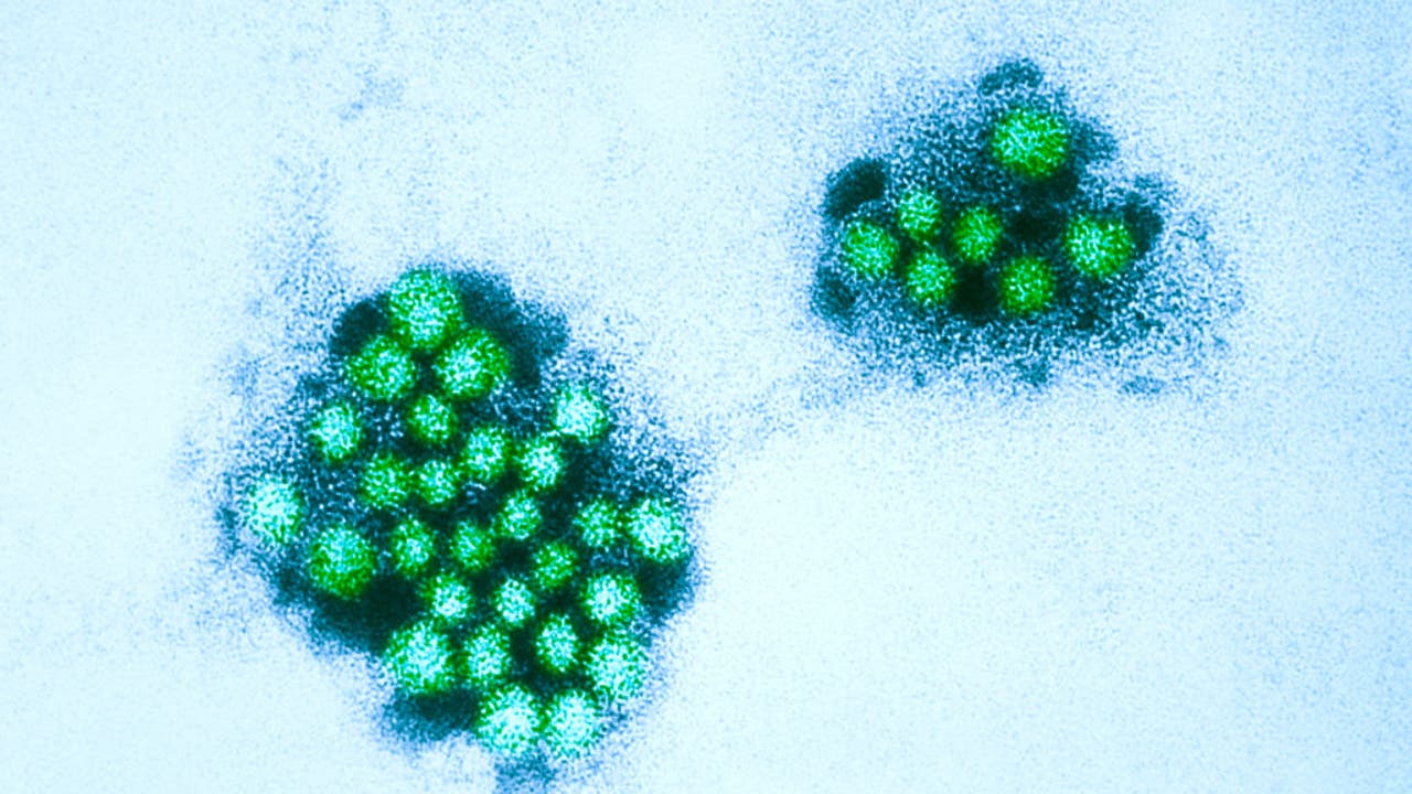 Norovirus cases spiking in California: What to know about 'winter ...