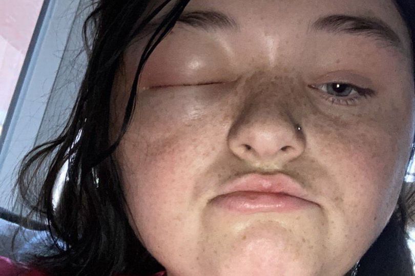 Teen's brain tumour symptoms repeatedly dismissed as 'exam stress ...