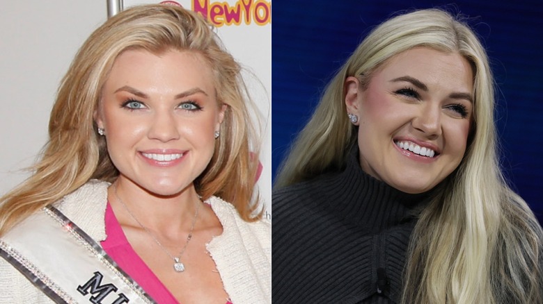Erika Kirk's face transformation since her pageant days is hard to ignore