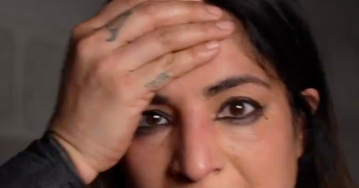 Raquel Rodriguez shows off nasty head injury after WWE RAW match