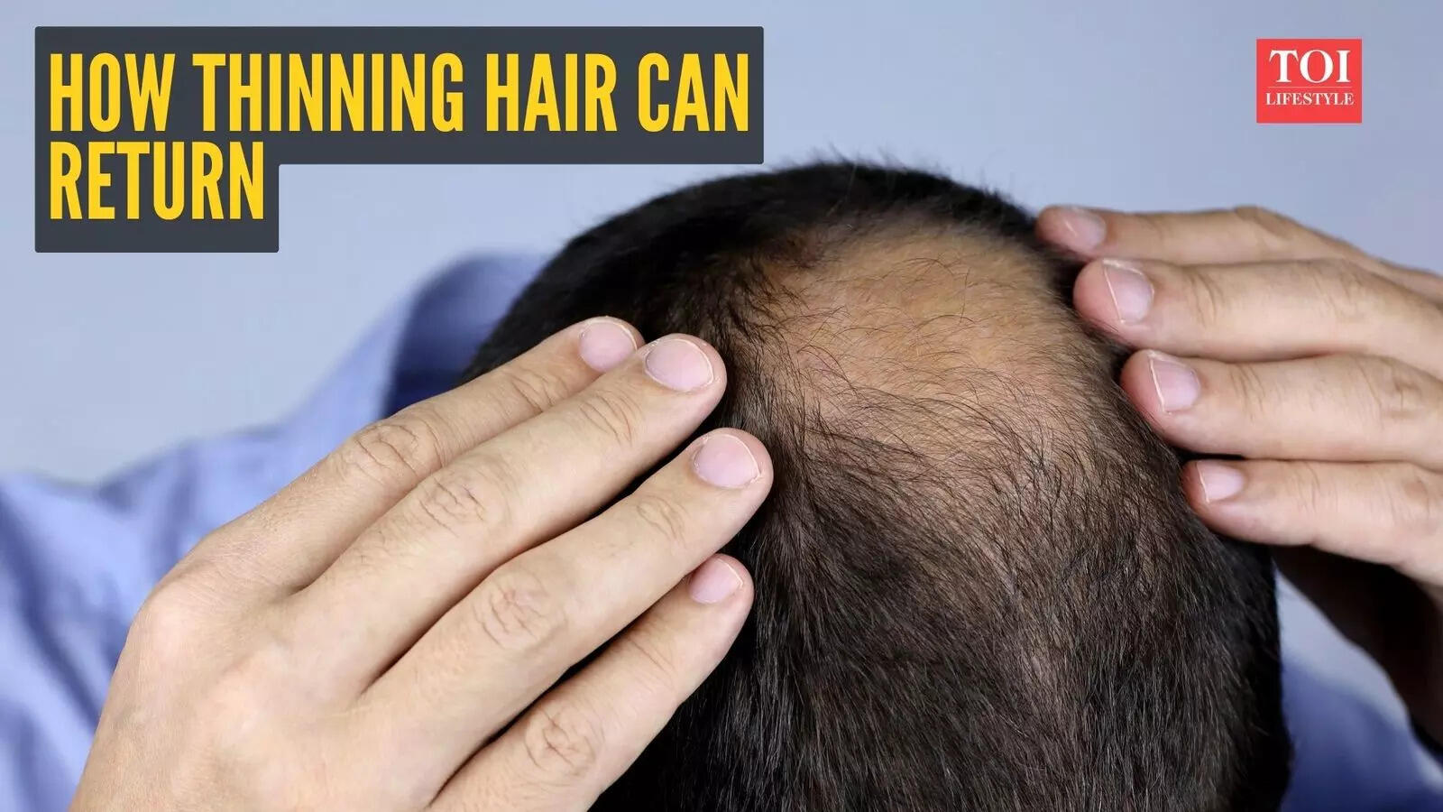 'Your hair can come back': Doctor shares science-backed plan to restore ...