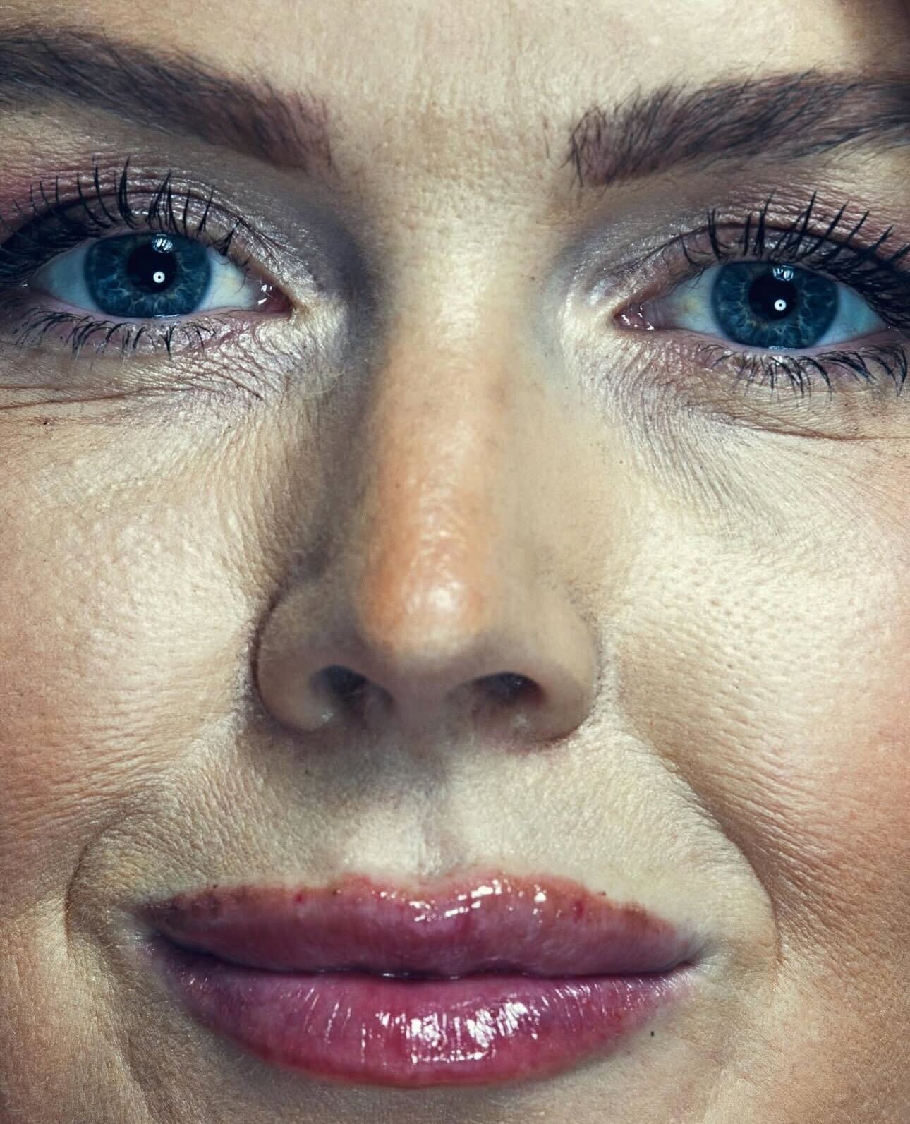 Karoline Leavitt’s cosmetic secrets brutally exposed in Vanity Fair shoot