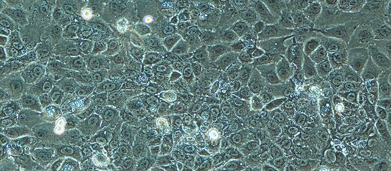 Lab platform models human organs to test cancer drug toxicity without ...