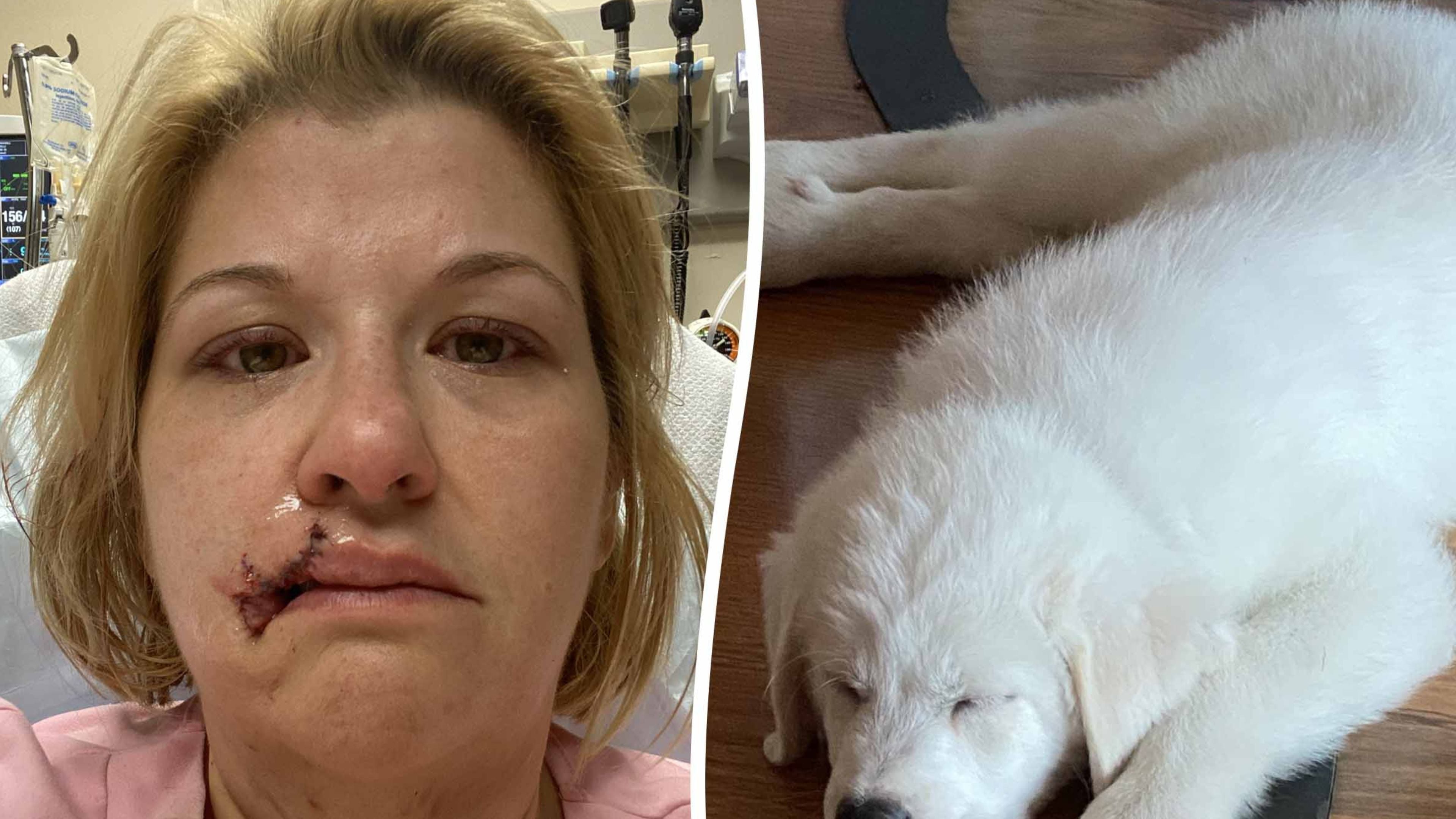 Woman's lip torn off in freak attack by 'loving' dog