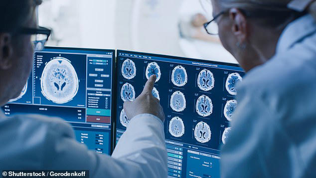 Scientists pinpoint four simple habits that can 'de-age' your brain by ...