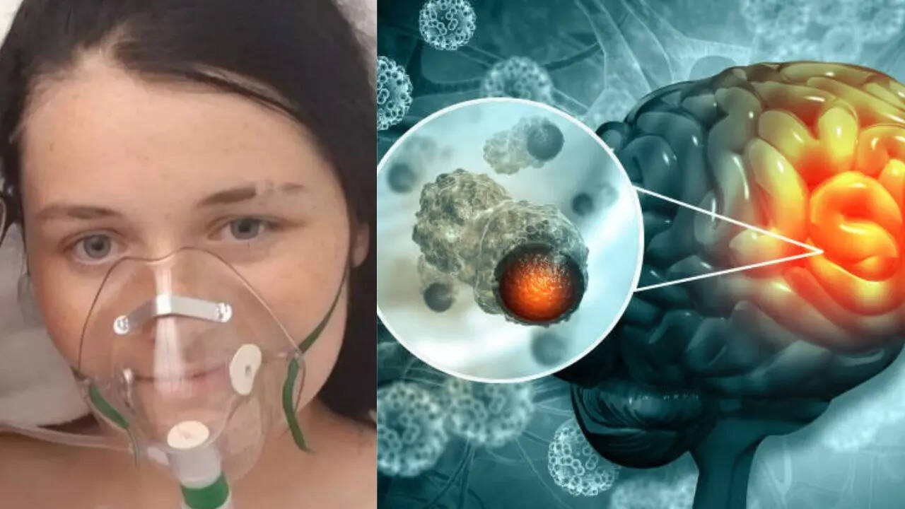 Doctors dismissed my symptoms as exam stress; I was later diagnosed ...