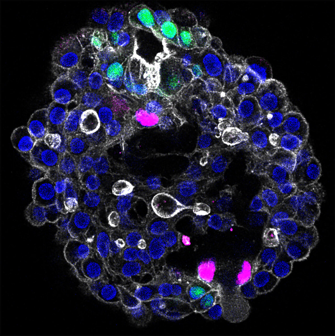 Patient-specific human liver model lays foundation for personalized ...