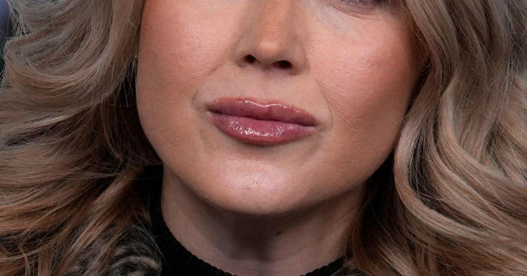 Karoline Leavitt sparks plastic surgery rumors as 'lip filler injections' are allegedly exposed ...
