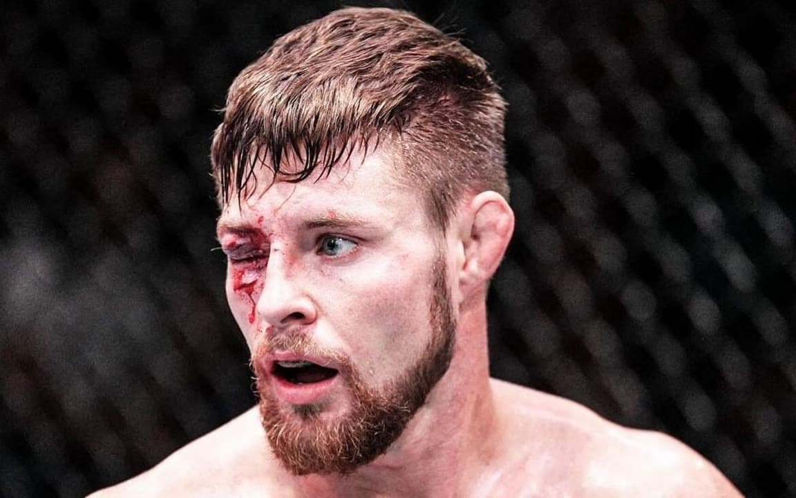 Lutador polêmico acusa campeão do UFC de bater na mulher: 'Covarde'