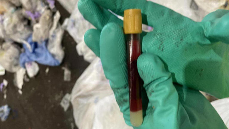 Dangerous medical waste, including body parts, found inside Minnesota ...